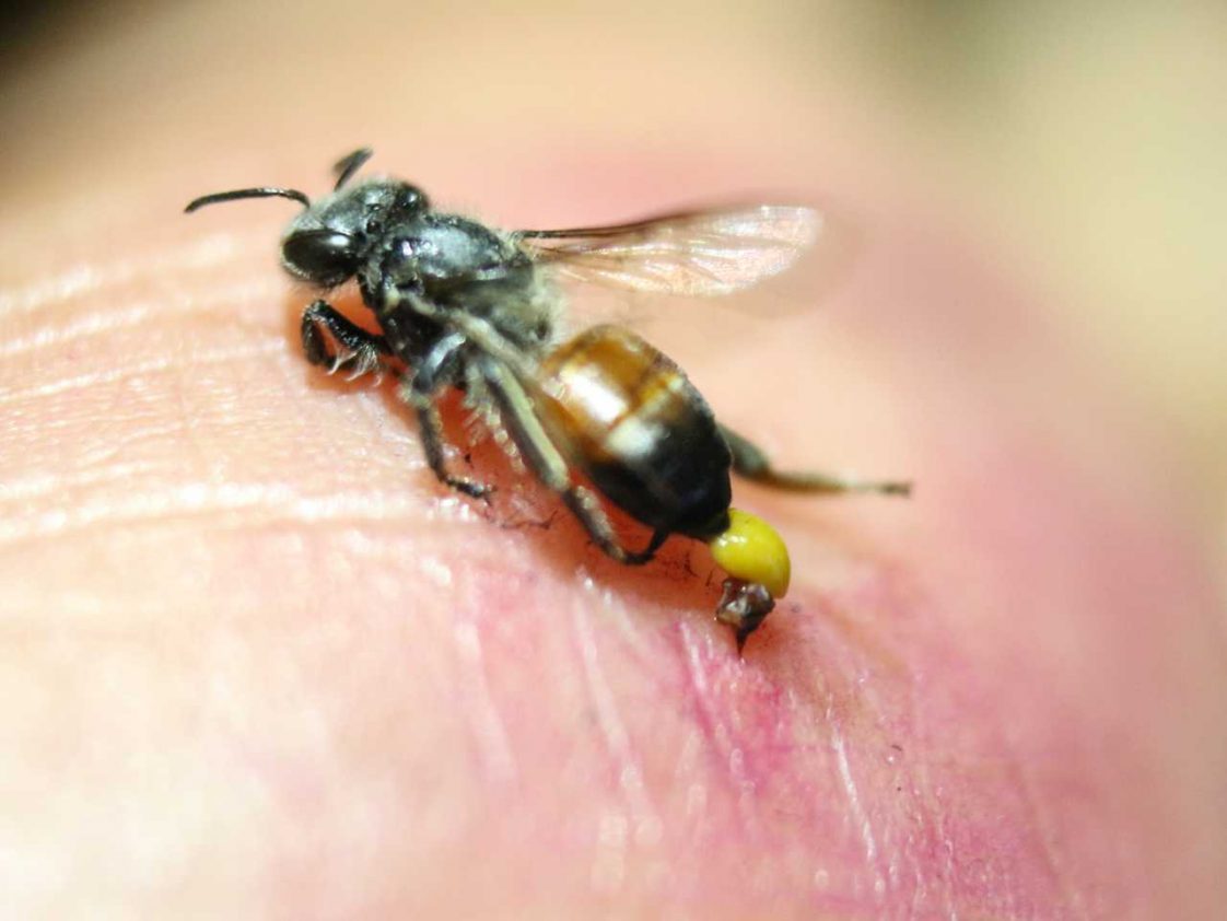 İLK YARDIM-39( HAYVAN ISIRIKLARI VE ARI SOKMASI) - DARGEB